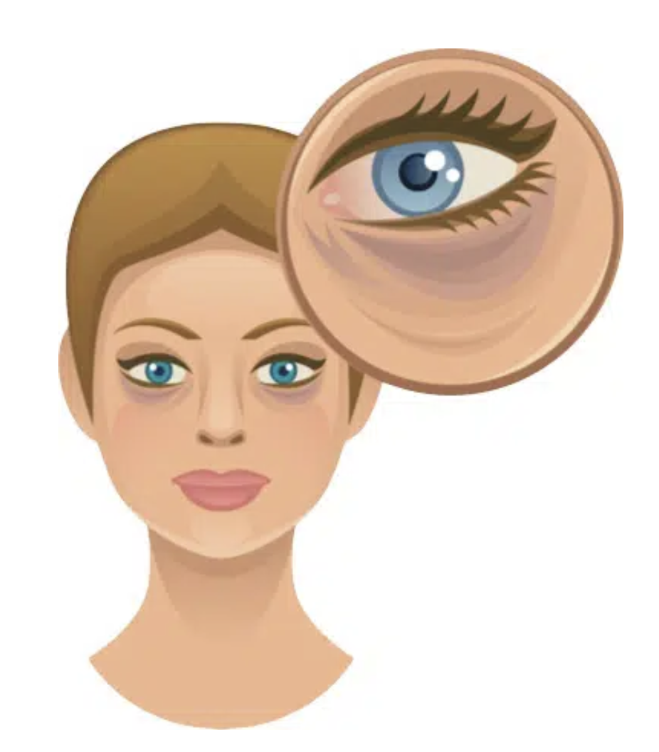 Face & Body Acne Map: Decode the Meaning of Your Breakouts