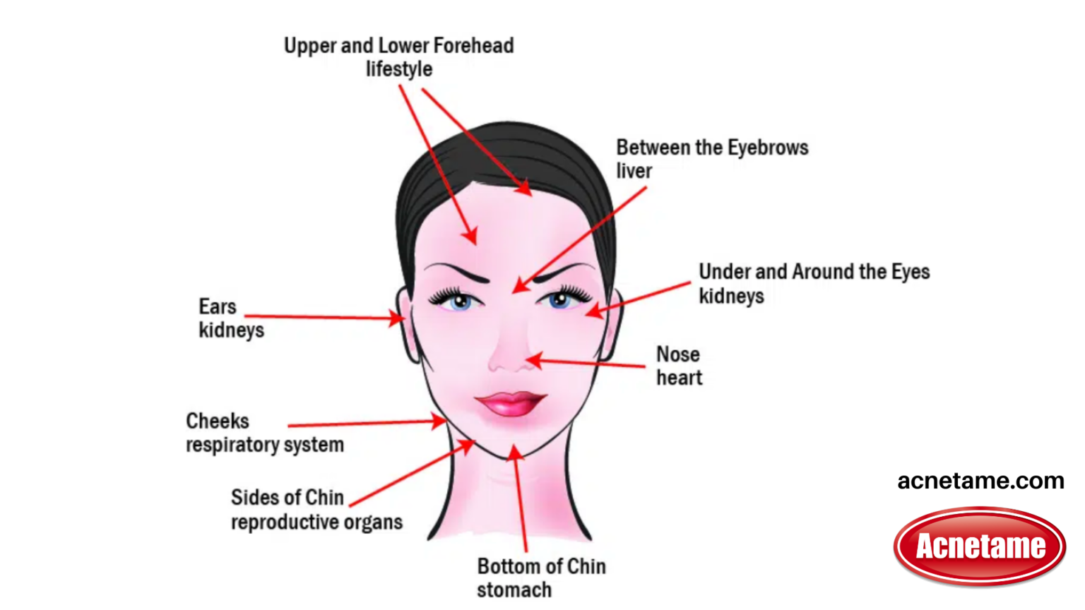 Face & Body Acne Map: Decode the Meaning of Your Breakouts